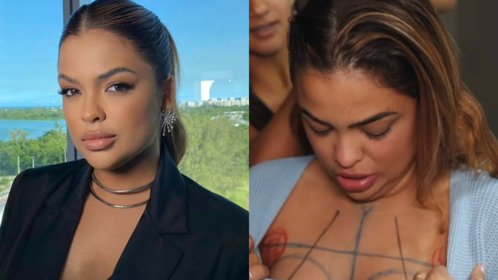 Ex-BBB Paula Freitas faz procedimento estético após ser humilhada nas redes sociais