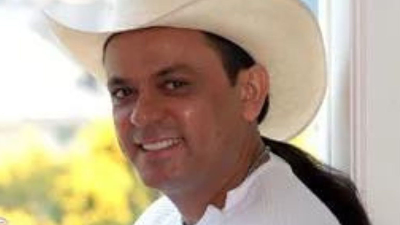 Frank Aguiar faz harmonização e web reage: 'A cara do David Brazil'