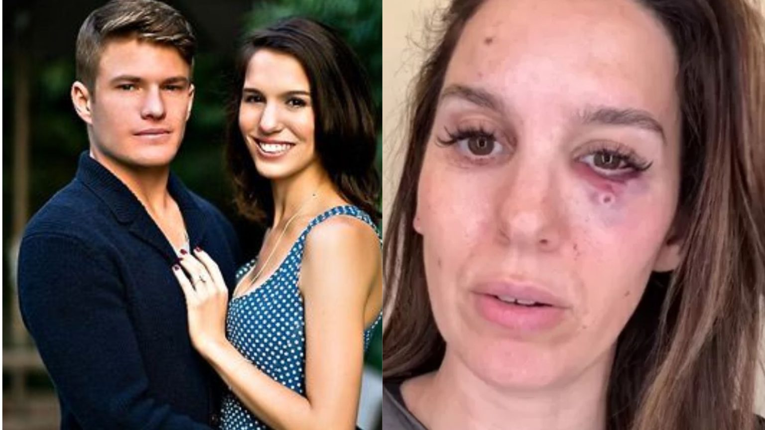 Meu Deus! Atriz leva tiros no aniversário do marido famoso