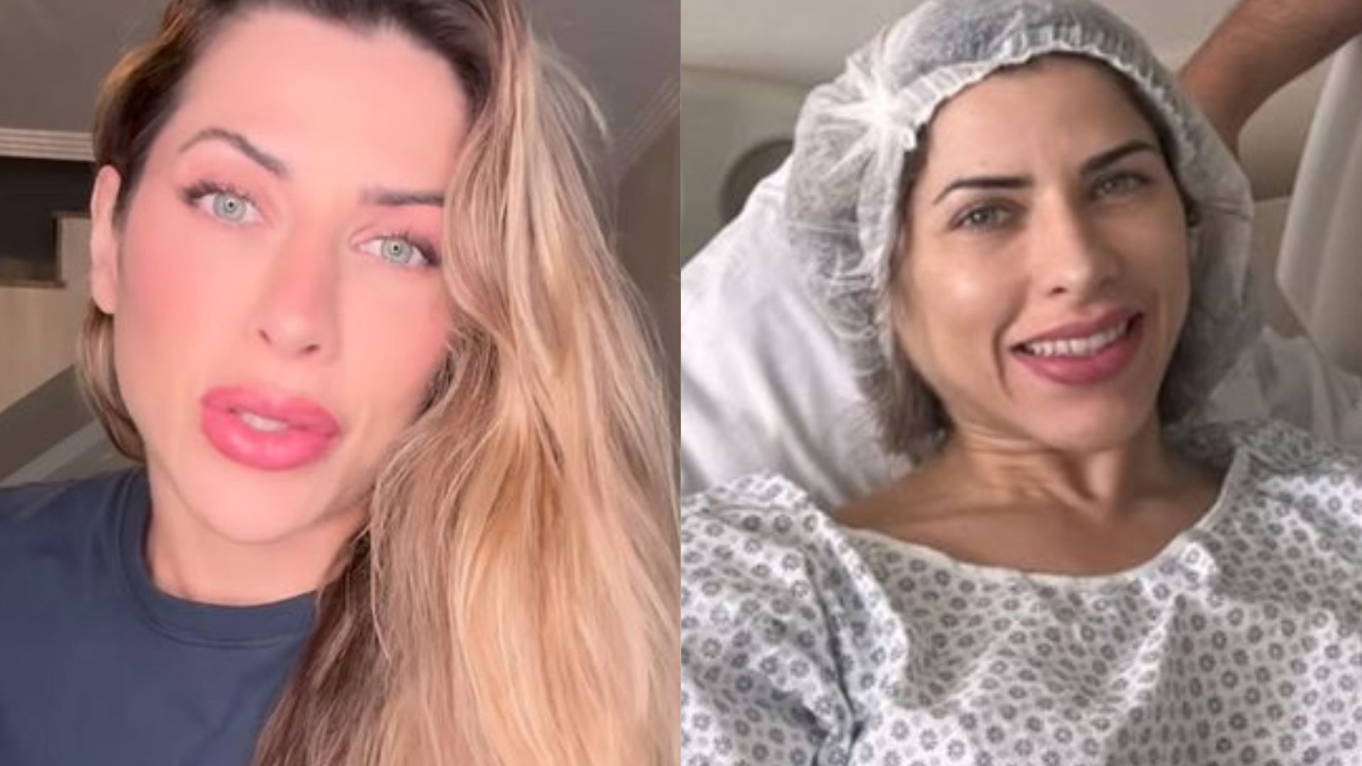 Ana Paula Minerato passa por cirurgia após diagnóstico delicado: 'Tardio'