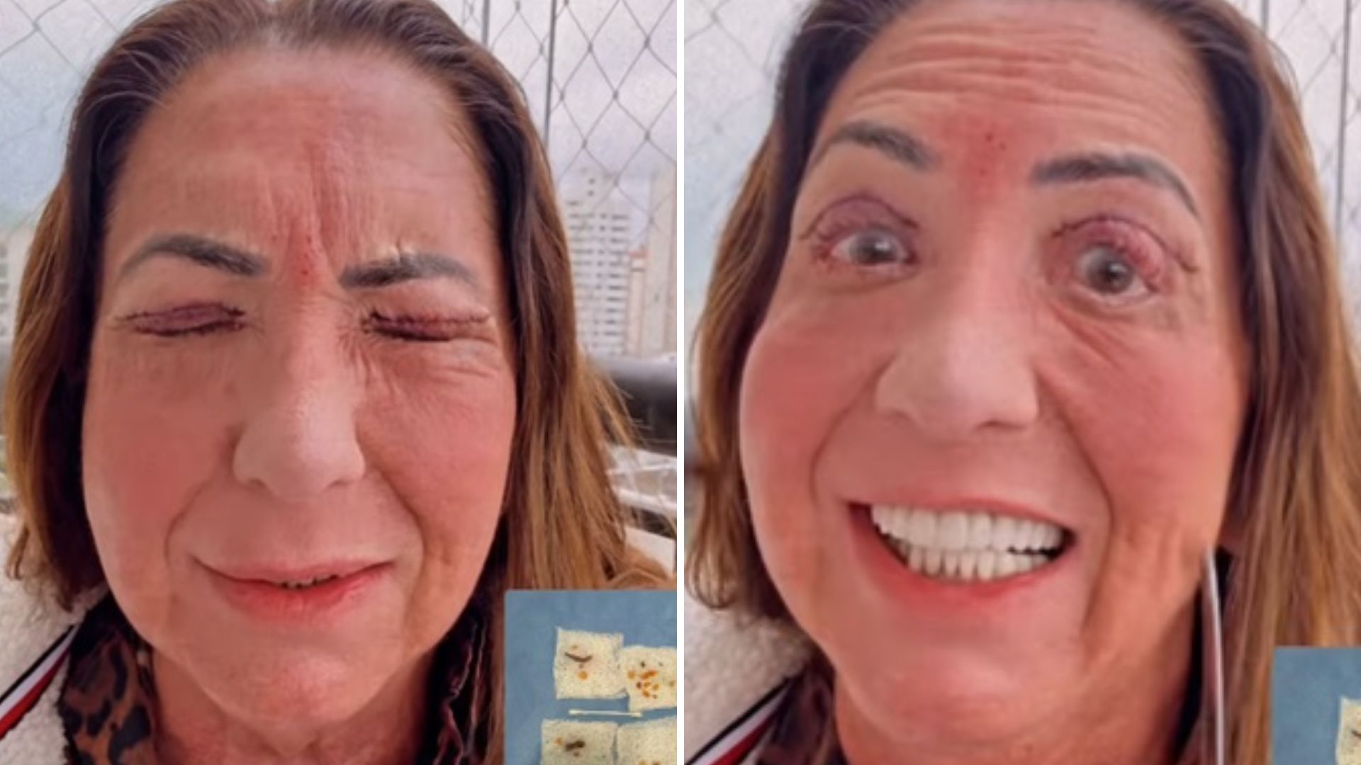 Mãe de Virginia Fonseca faz cirurgia nos olhos e médico alerta ...
