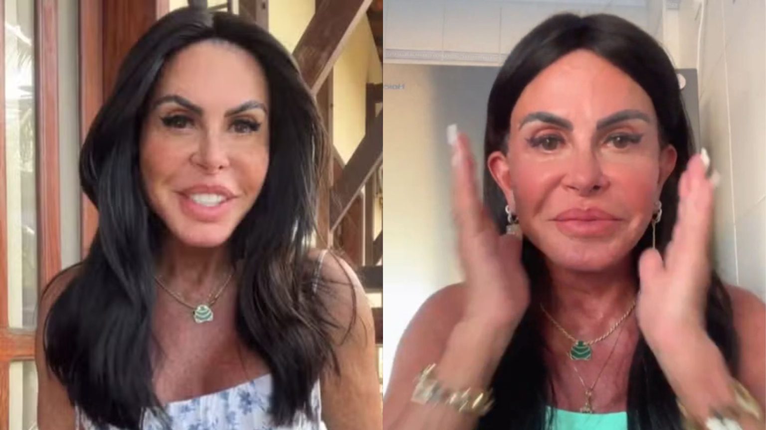 Gretchen quebra silêncio após onda de críticas sobre aparência: 'Recalcadas'